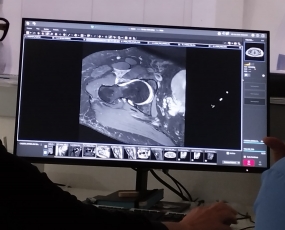 Unidad de Diagnóstico por Imagen I Radiología I Hospital MiKS Ospitalea